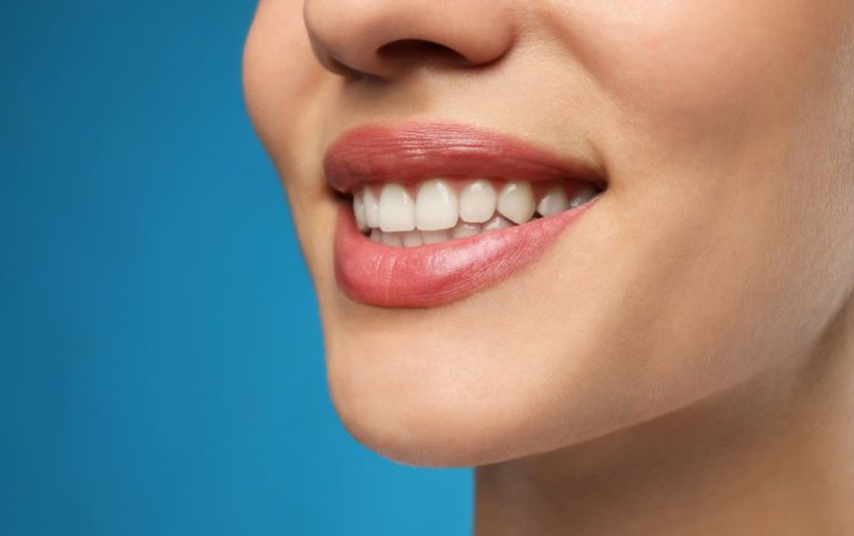 How To Straighten Teeth | Dentist in Croydon